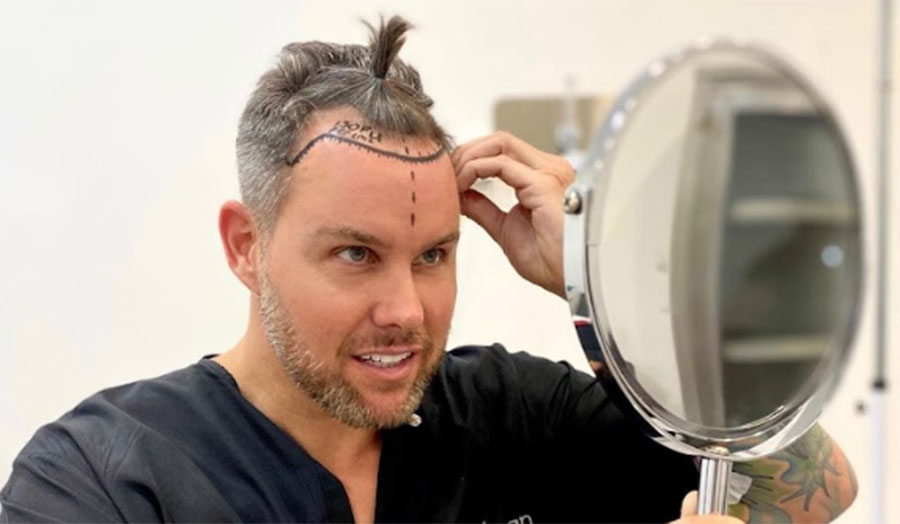Experience Excellence In Hair Transplant At Aslı Tarcan Clinic Turkey